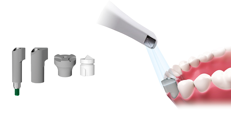 Scan body and intraoral scanners: what they are and how they work ...