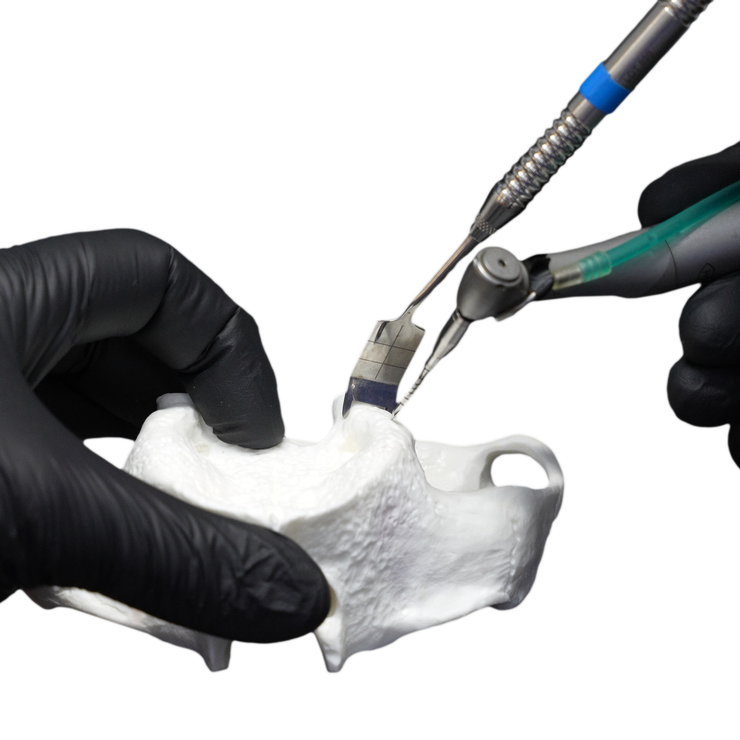 JDPterygo Retractor: Gingival retractor for pterygoid implants